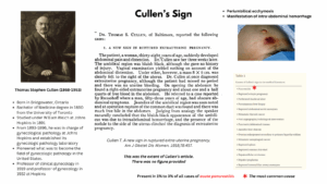 Eponyms in Hematology - Cullen's Sign • The Blood Project