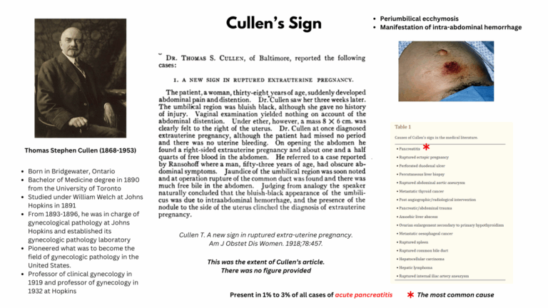 Eponyms in Hematology - Cullen's Sign • The Blood Project
