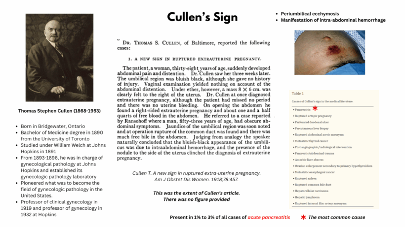 Eponyms in Hematology - Cullen's Sign • The Blood Project