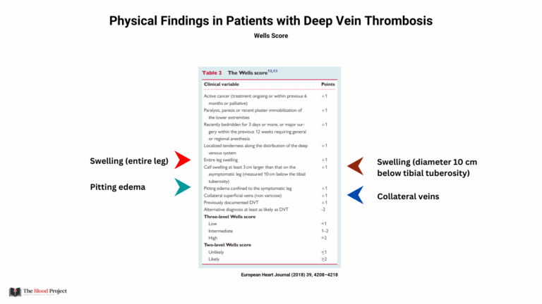 Physical Exam in Patients with Deep Vein Thrombosis • The Blood Project