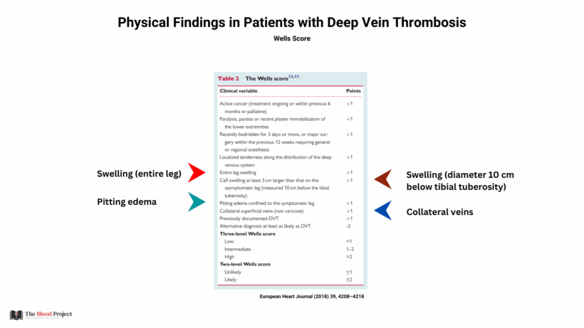 Physical Exam in Patients with Deep Vein Thrombosis • The Blood Project