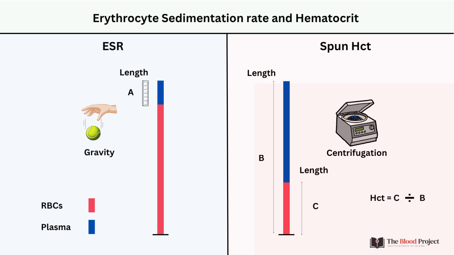 Erythrocyte Sedimentation Rate • The Blood Project