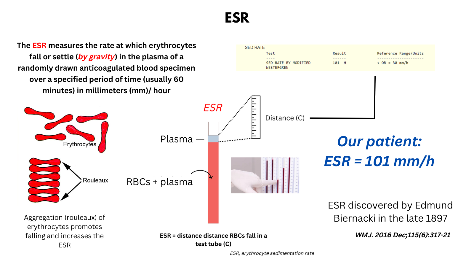 Erythrocyte Sedimentation Rate • The Blood Project