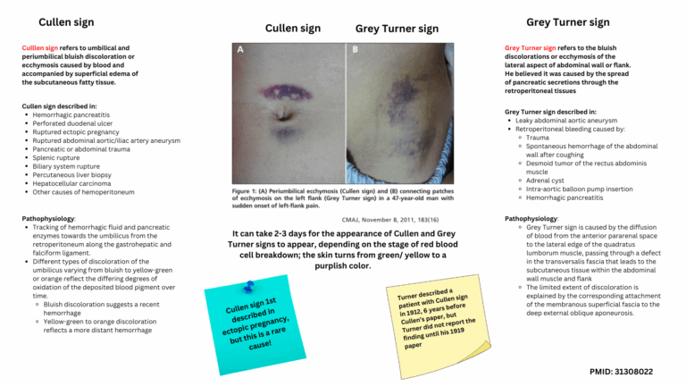 Eponyms in Hematology - Cullen's Sign • The Blood Project