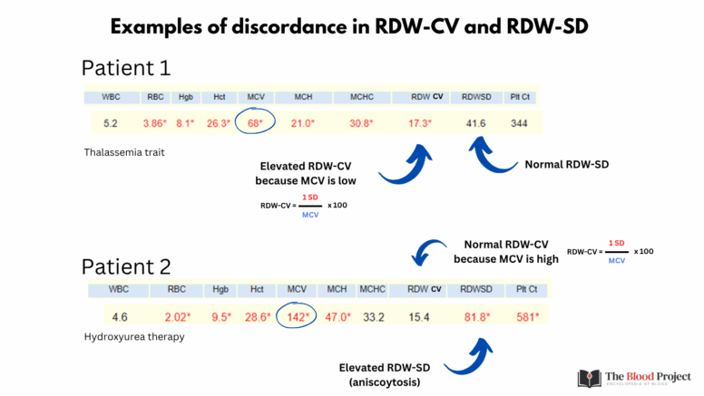 Red Cell Distribution Width (RDW) • The Blood Project