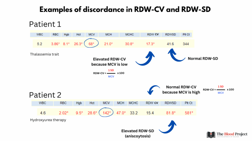 Red Cell Distribution Width (RDW) • The Blood Project