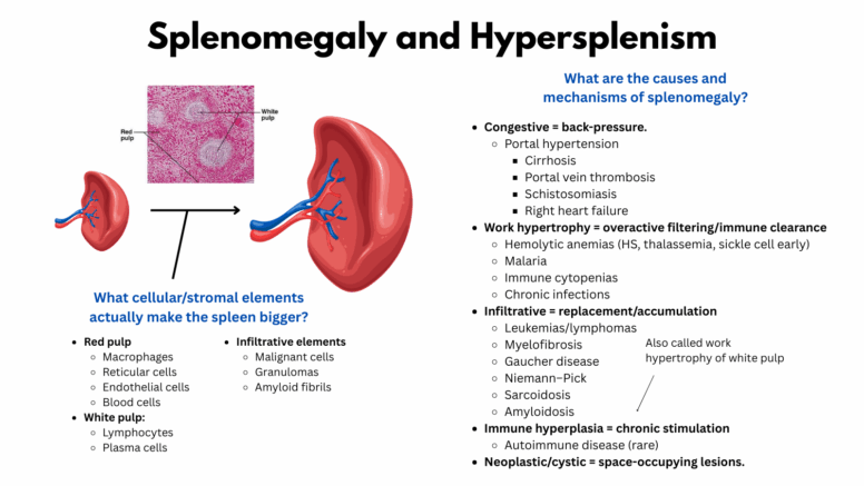 Hypersplenism • The Blood Project
