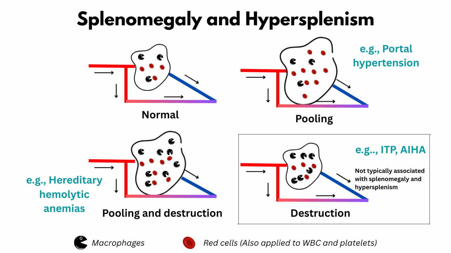 Hypersplenism • The Blood Project