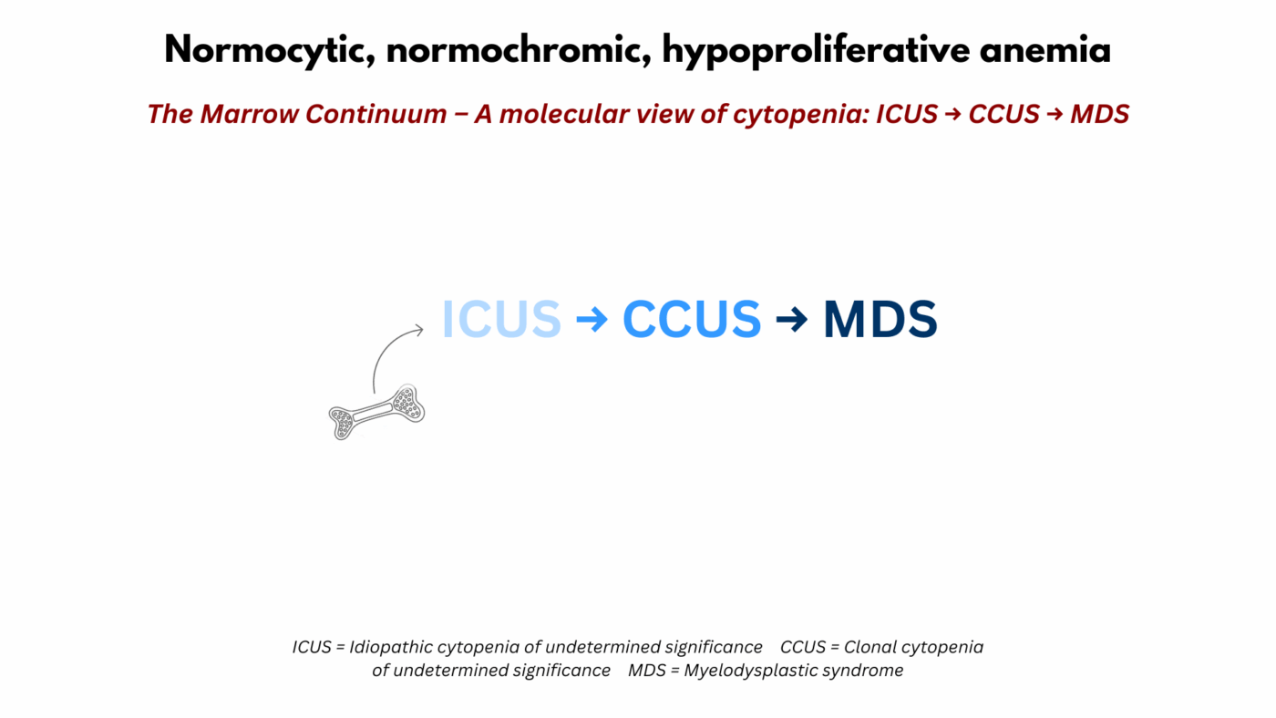 Approach to Normocytic Normochromic Anemia • The Blood Project